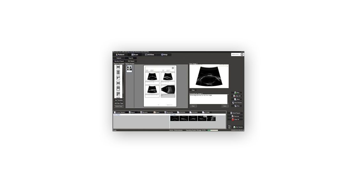 Ellex Eye Cubed™ Ophthalmic Ultrasound