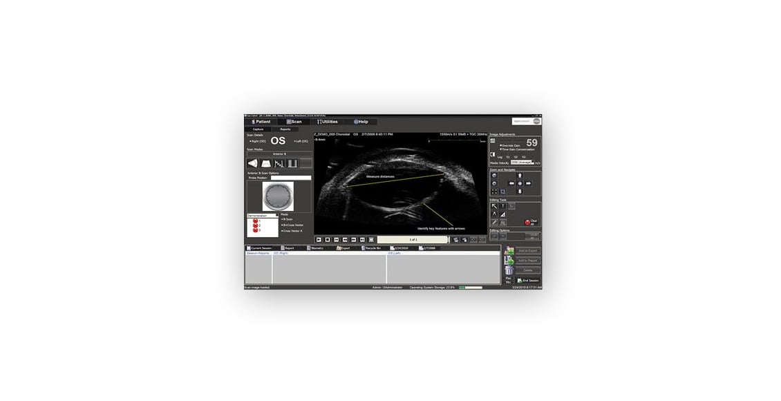 Ellex Eye Cubed™ Ophthalmic Ultrasound