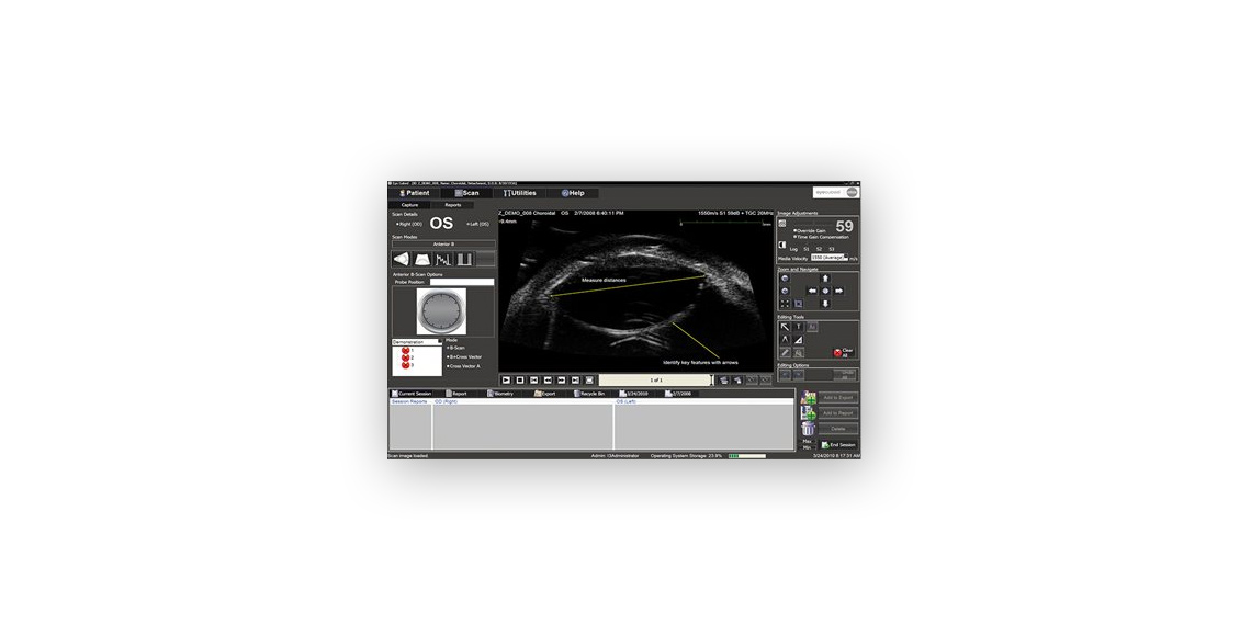 Eye CubedMC d'Ellex